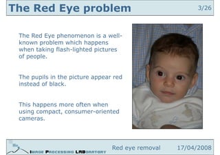 Red Eye Removal | PDF