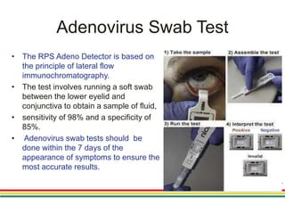RED EYE diagnosis causative agent and control measures | PPT