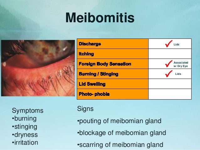 Evaluation of Red Eye; June 2014