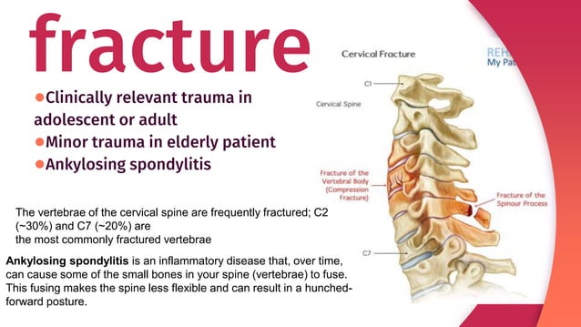 Red flags of cervical pain | PPT