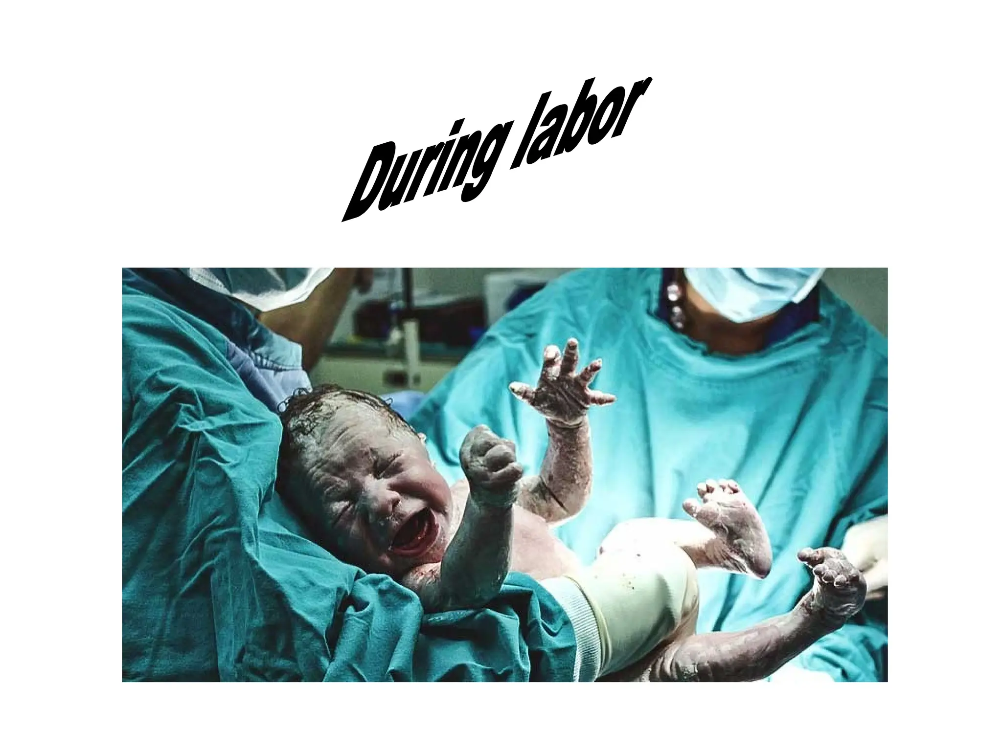 red flags for neonatal renal disorders.ppt