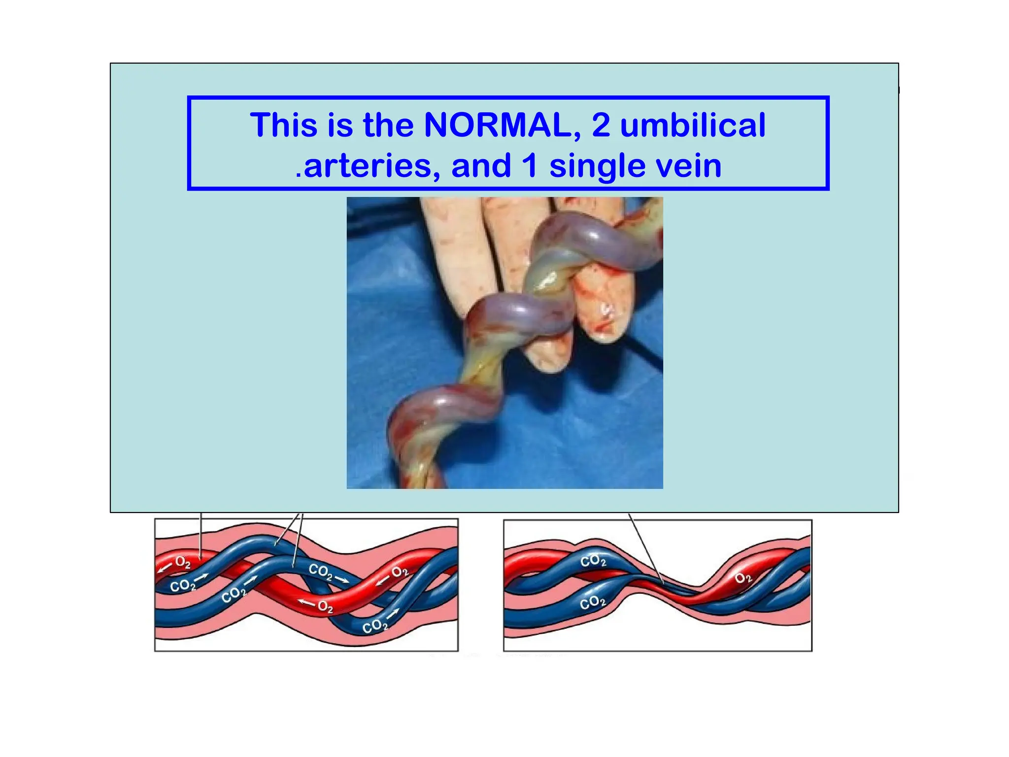 red flags for neonatal renal disorders.ppt
