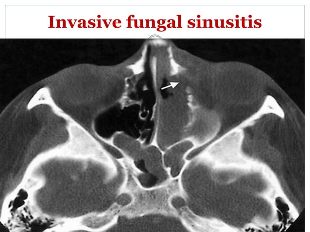 EMERGENCY RED FLAGS | PPTX