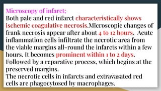 RED INFARCTS powerpoint presentation basics | PPTX