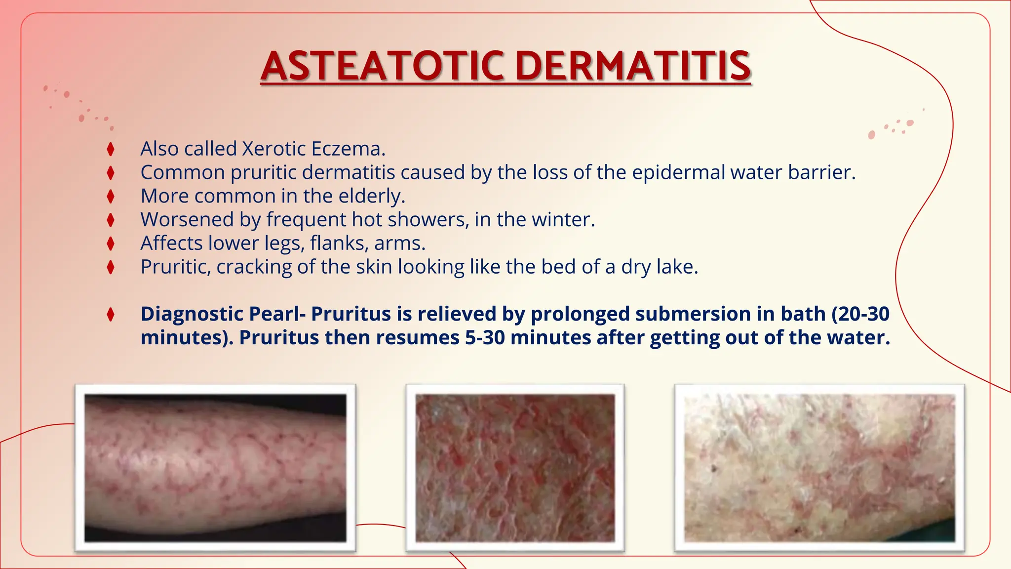 RED LEG PPT DERMATOLOGY PRESENTATION.pptx