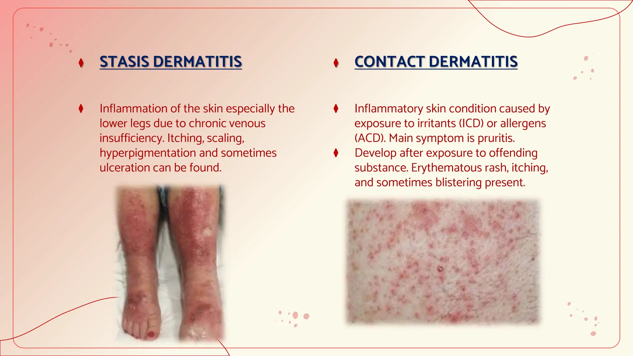 RED LEG PPT DERMATOLOGY PRESENTATION.pptx