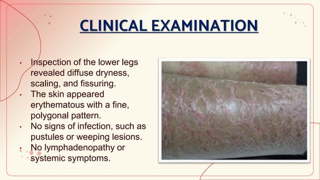RED LEG PPT DERMATOLOGY PRESENTATION.pptx | Foot Health | Diseases and ...