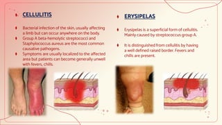 RED LEG PPT DERMATOLOGY PRESENTATION.pptx | Foot Health | Diseases and ...