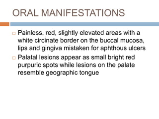 RED LESIONS | PPTX