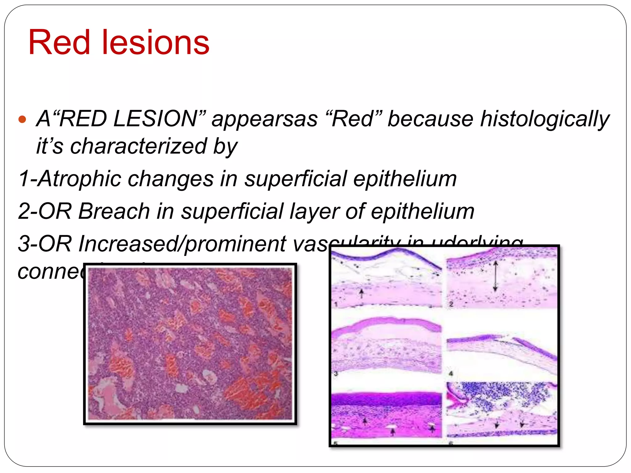 Red Lesions #1.pptx