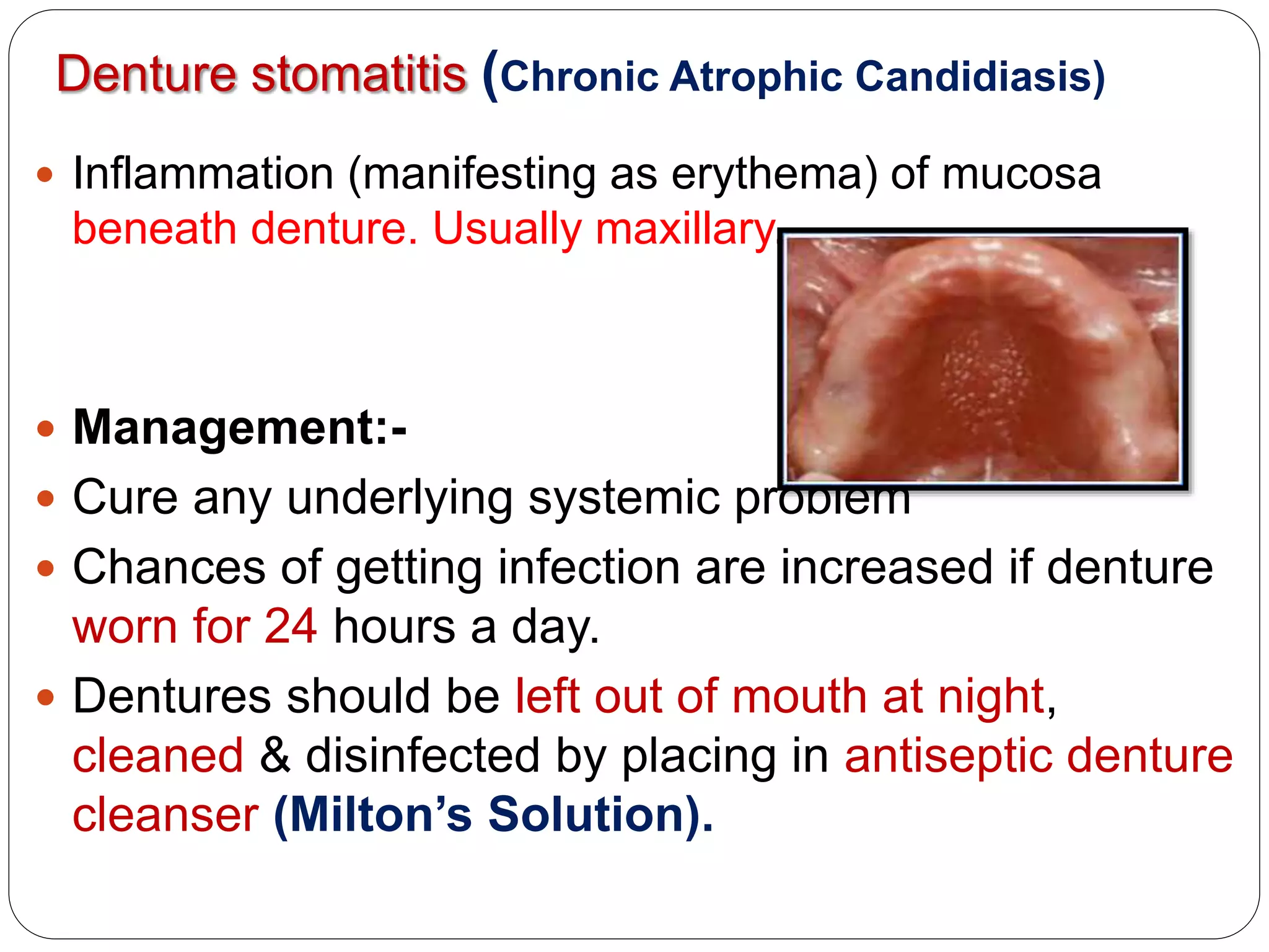 Red Lesions #1.pptx