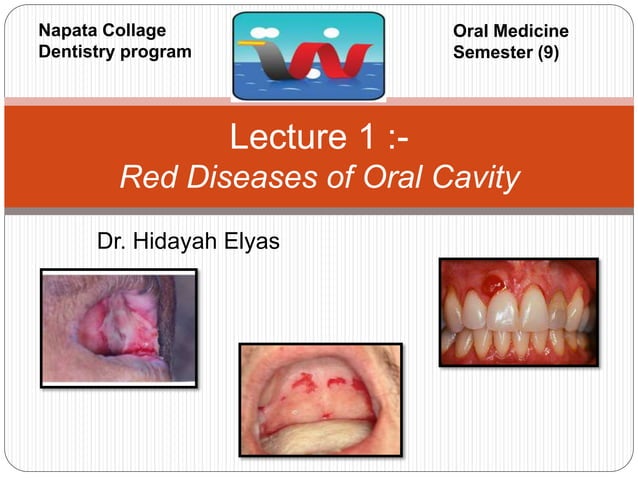 Red Lesions #1.pptx