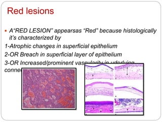 Red Lesions #1.pptx