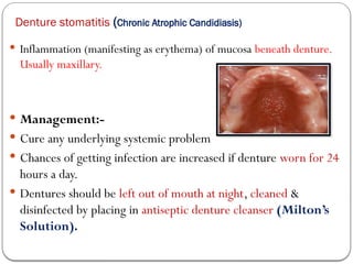 Red Lesions #1.pptx of oral cavity oral medicine | PPTX