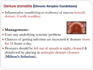 Red Lesions of the oral cavity #1 copy.pdf