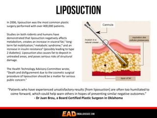 Red Light vs Liposuction for Weight Loss & Obesity | PPT