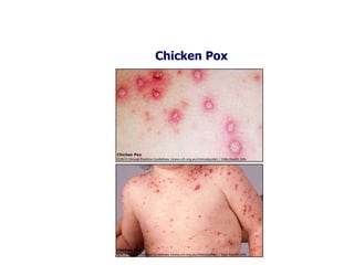 Redtrain Parent First Aid - Paediatric First Aid for Parents | PPTX ...