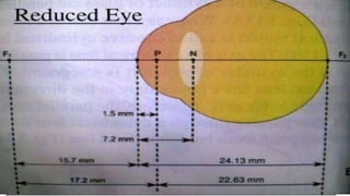 Reduced eye | PPTX