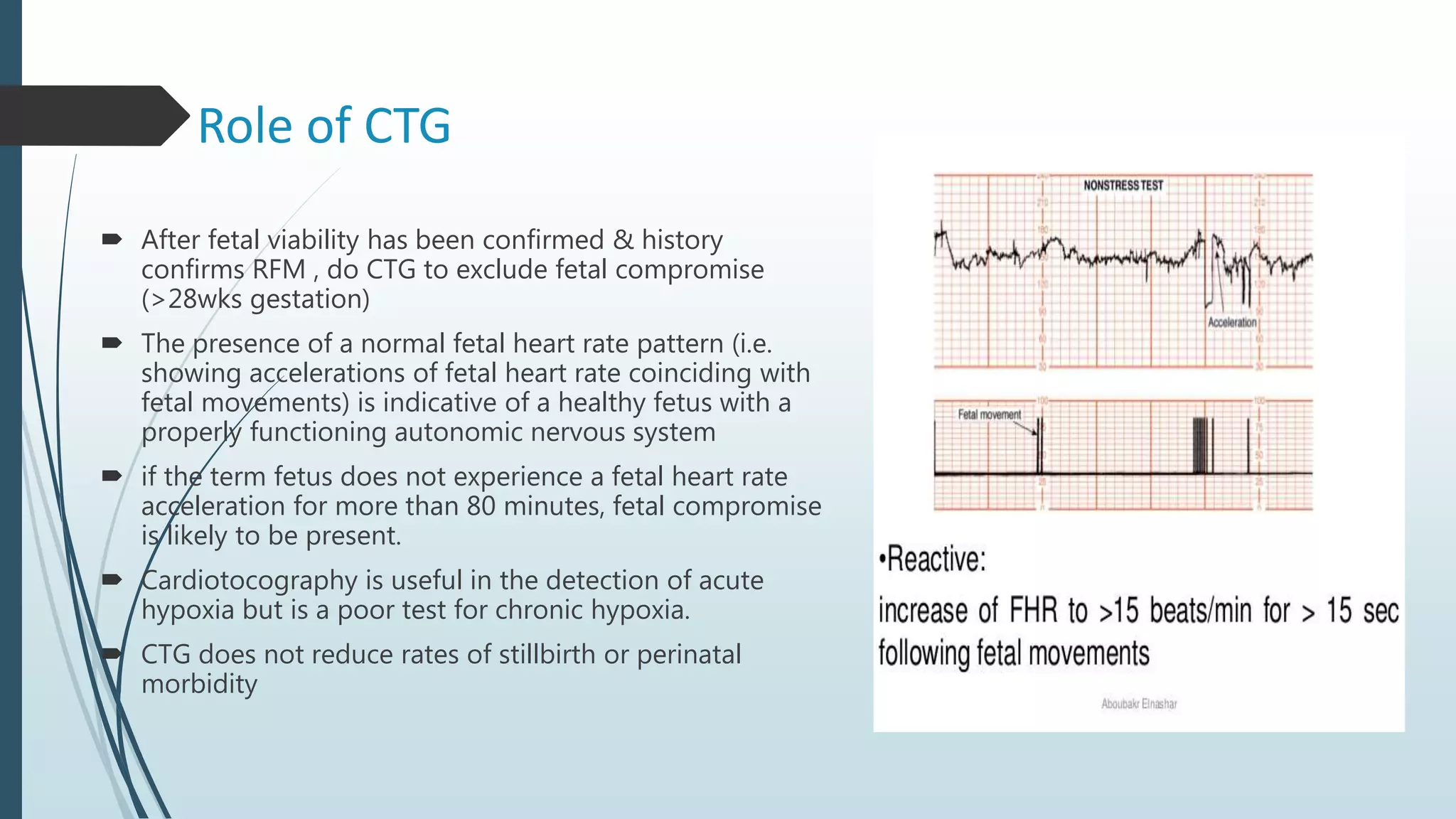Reduced fetal movements | PPTX