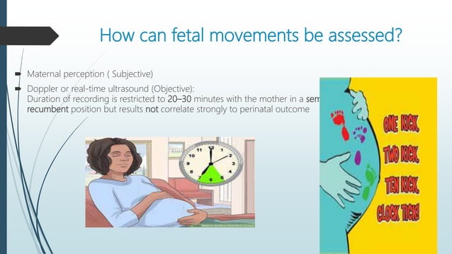 Reduced fetal movements | PPTX | Pregnancy | Reproductive Health