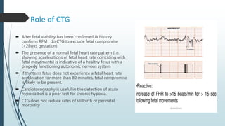 Reduced fetal movements | PPTX