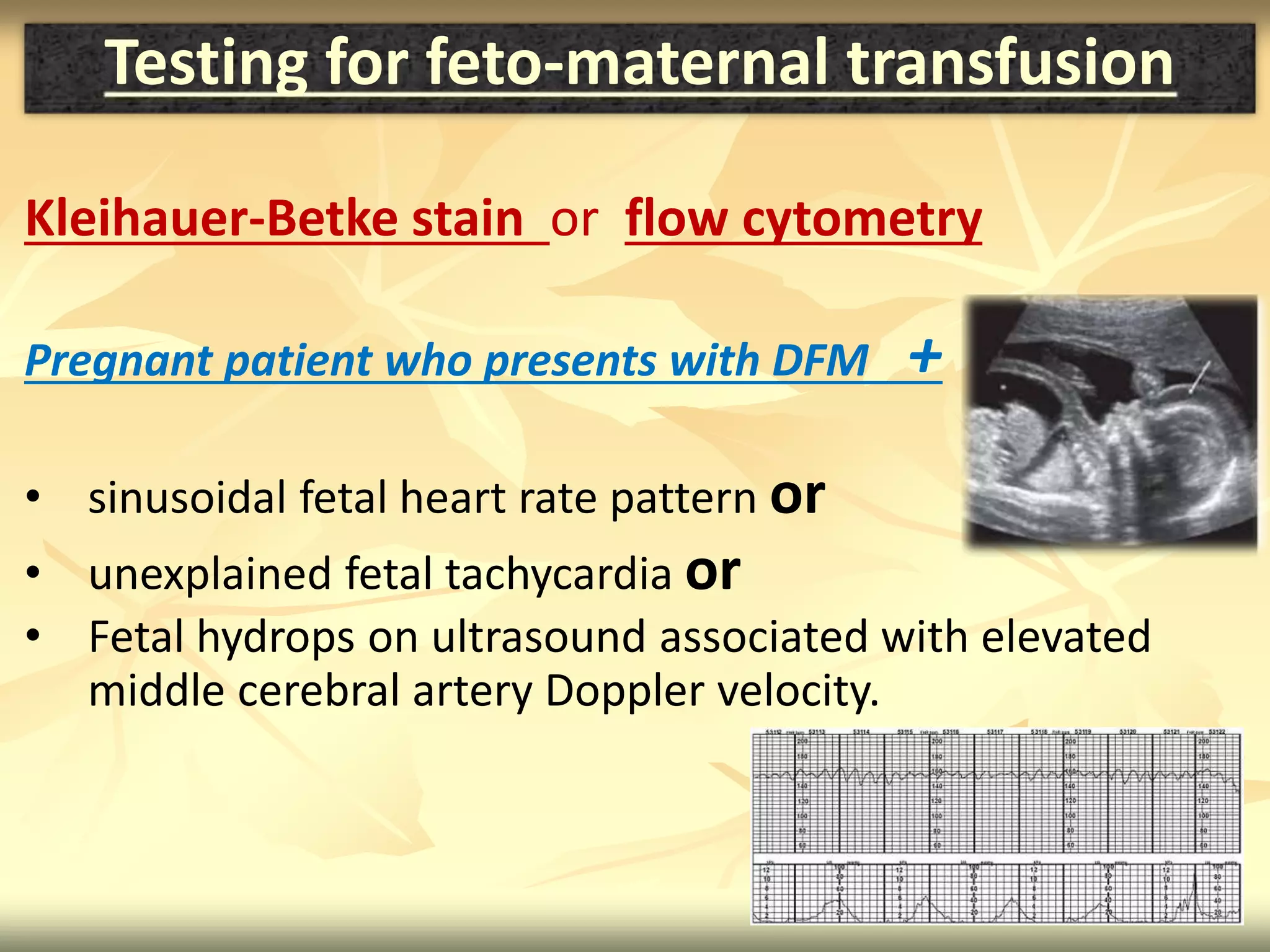 REDUCED FETAL MOVEMENTS - HOW TO PROCEED BY DR SHASHWAT JANI | PPTX