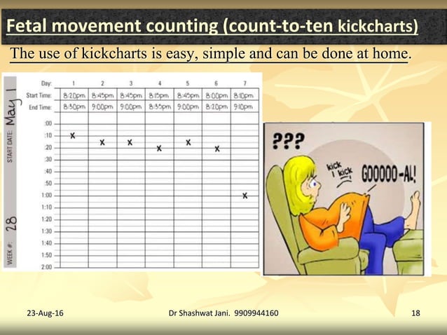 REDUCED FETAL MOVEMENTS - HOW TO PROCEED BY DR SHASHWAT JANI | PPTX ...