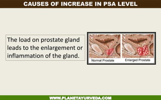 Reduce psa naturally | PPTX