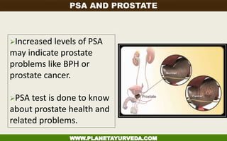Reduce psa naturally | PPTX