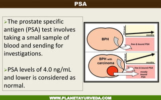 Reduce psa naturally | PPTX