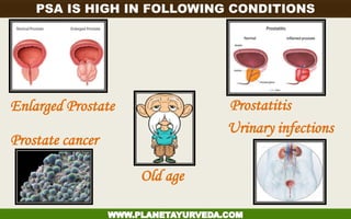 Reduce psa naturally | PPTX