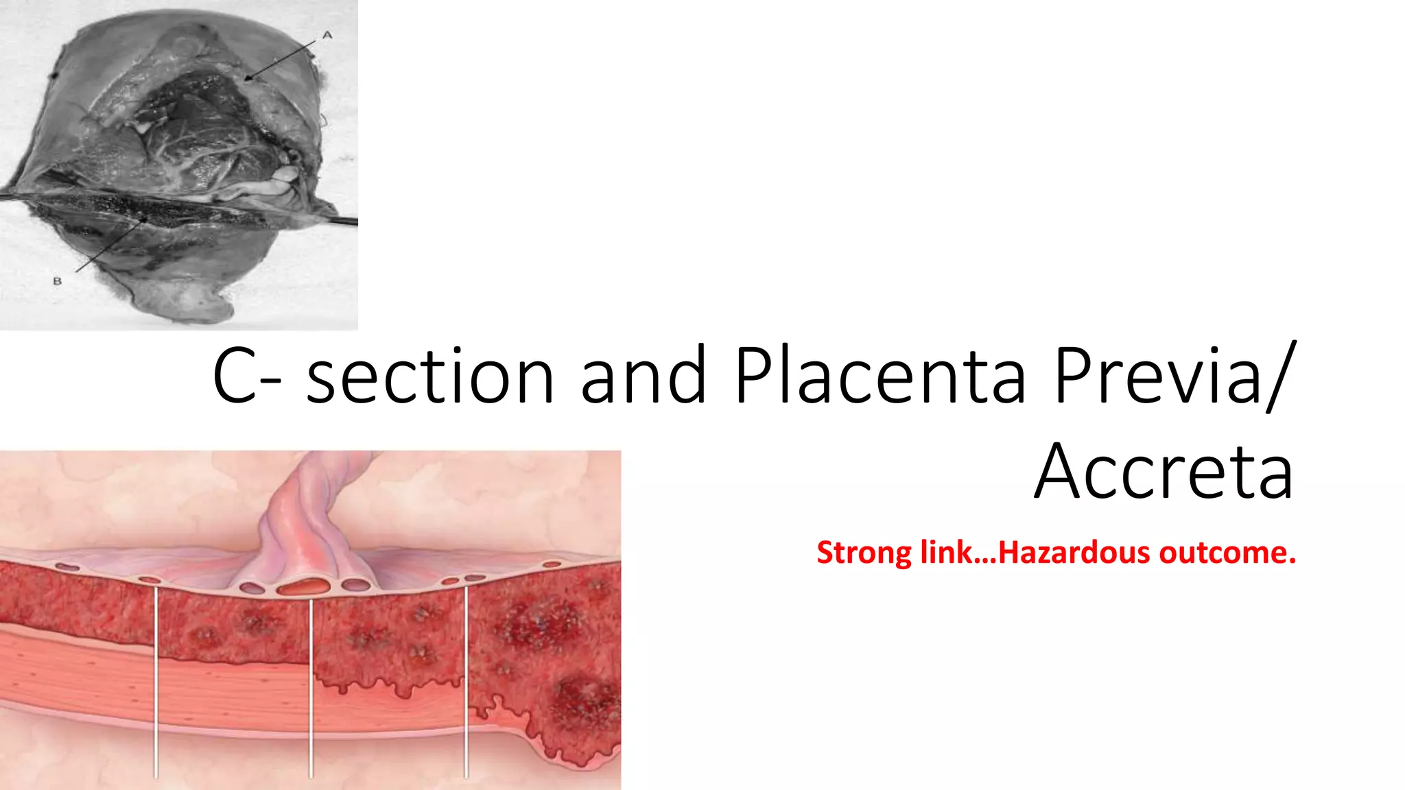 Reducing cesarean section rate. a national demand | PPTX