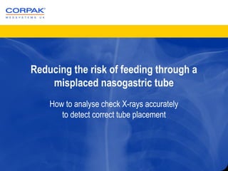Reducing Risk of Misplaced Nasogastric Tube.pptx