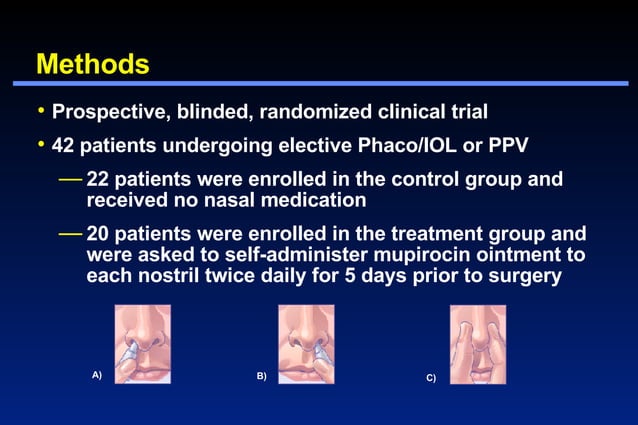 Reduction of Conjunctival Bacterial Flora with the Use of Mupirocin ...
