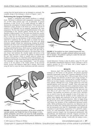 Reduction mammoplasty with superolateral dermoglandular | PDF