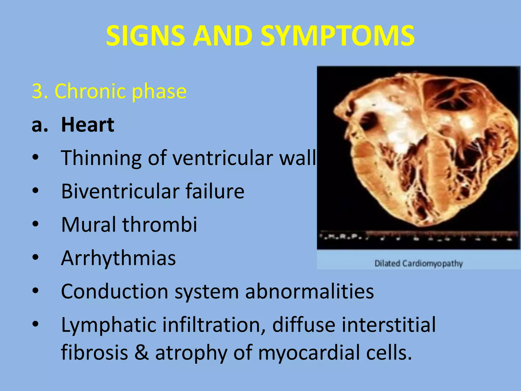 Reduviid bug And Chagas Disease | PPTX