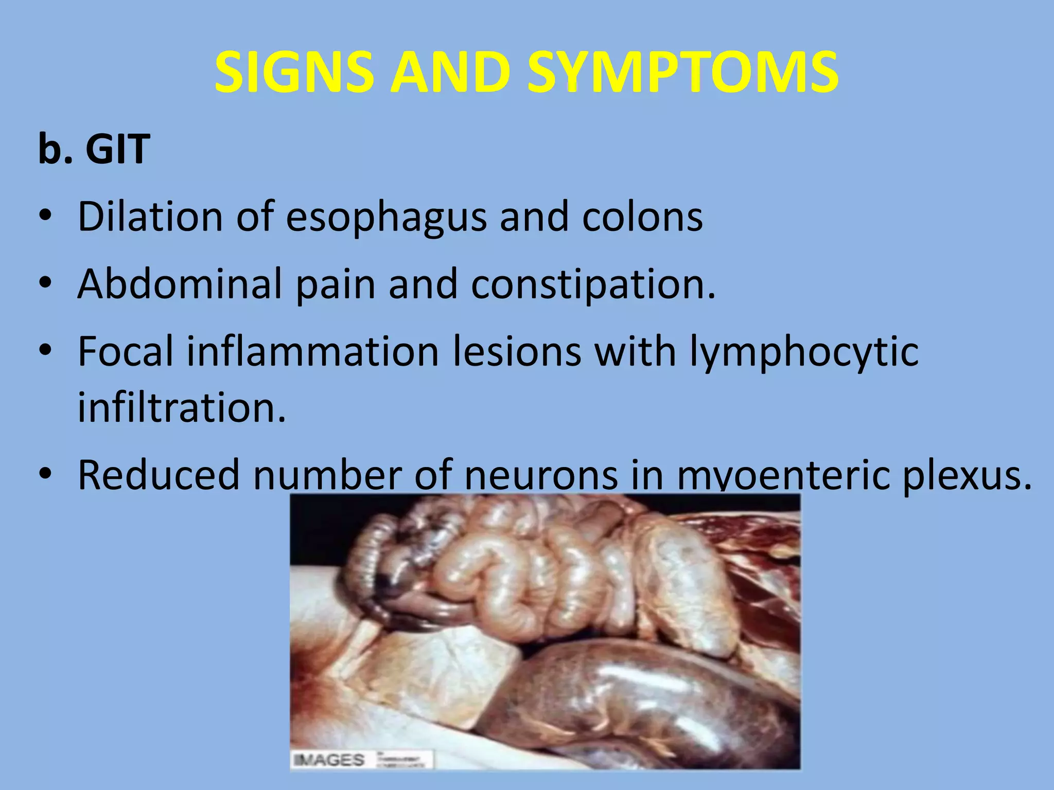 Reduviid bug,T. cruzi & Chagas disease | PPTX