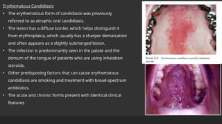 red & white disease of oral cavity...... | PPTX