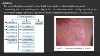 red & white disease of oral cavity...... | PPTX