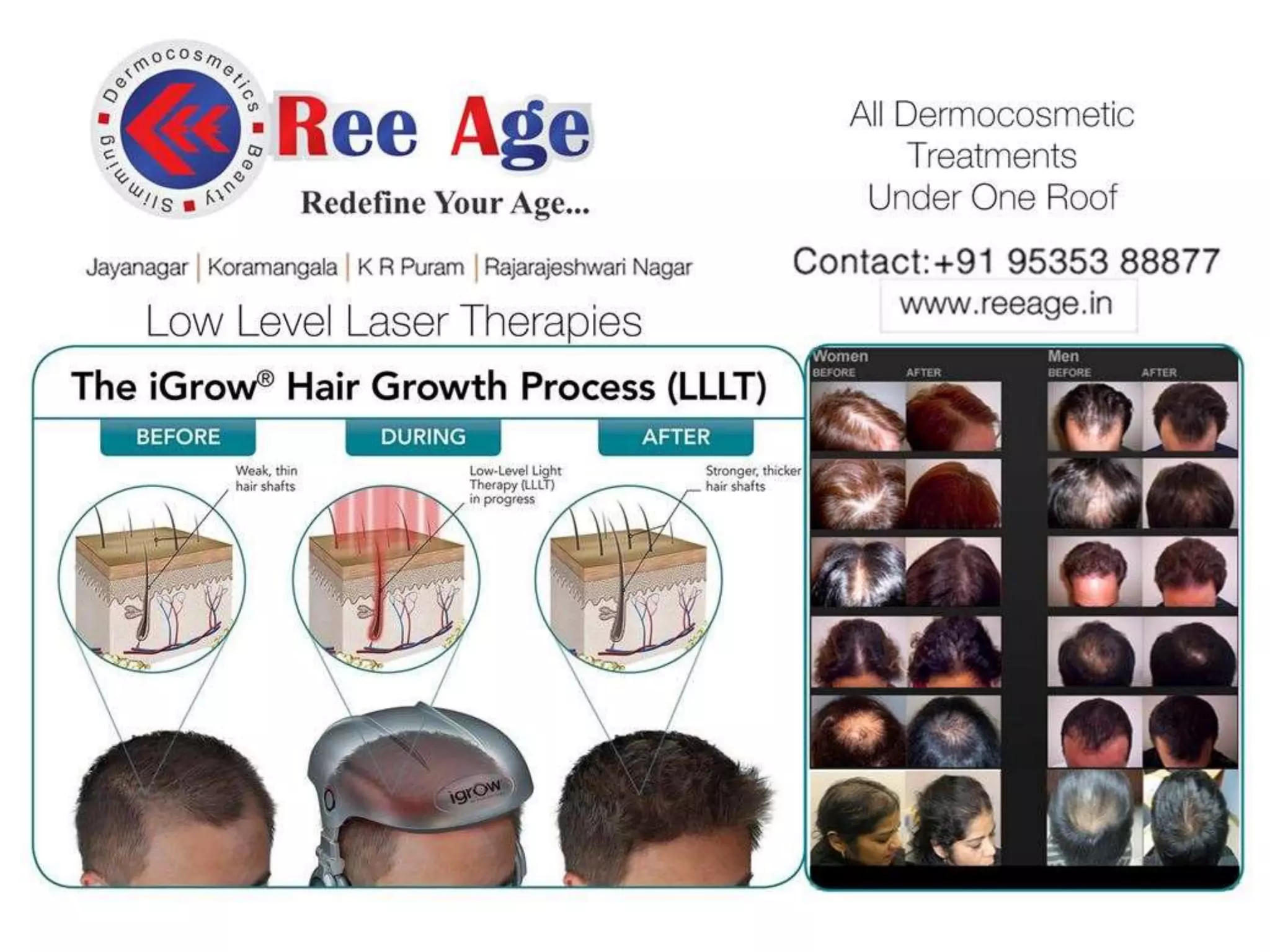 Ree age presentation2 | PPT