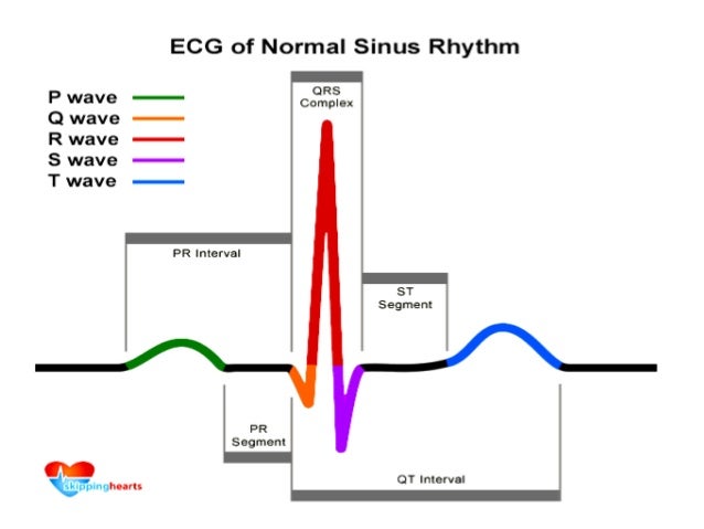 electrocardiography
