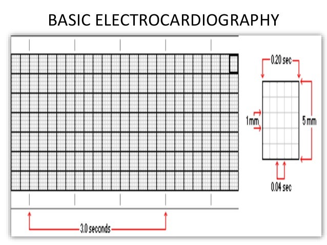 electrocardiography