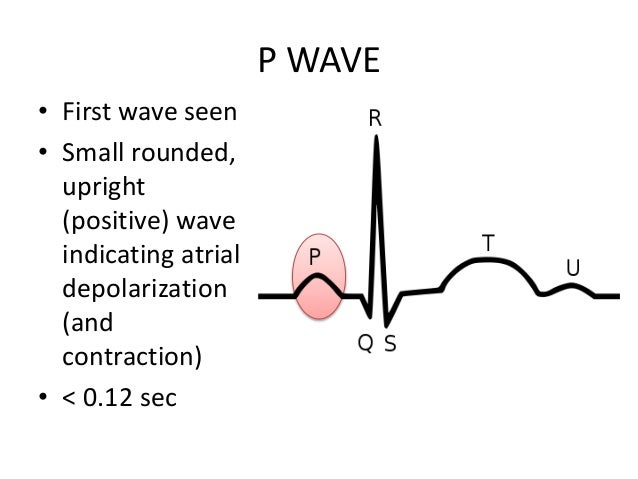 electrocardiography