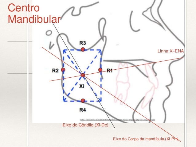 Norma lateral de Ricketts