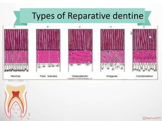 Reem hussam dentin | PPTX