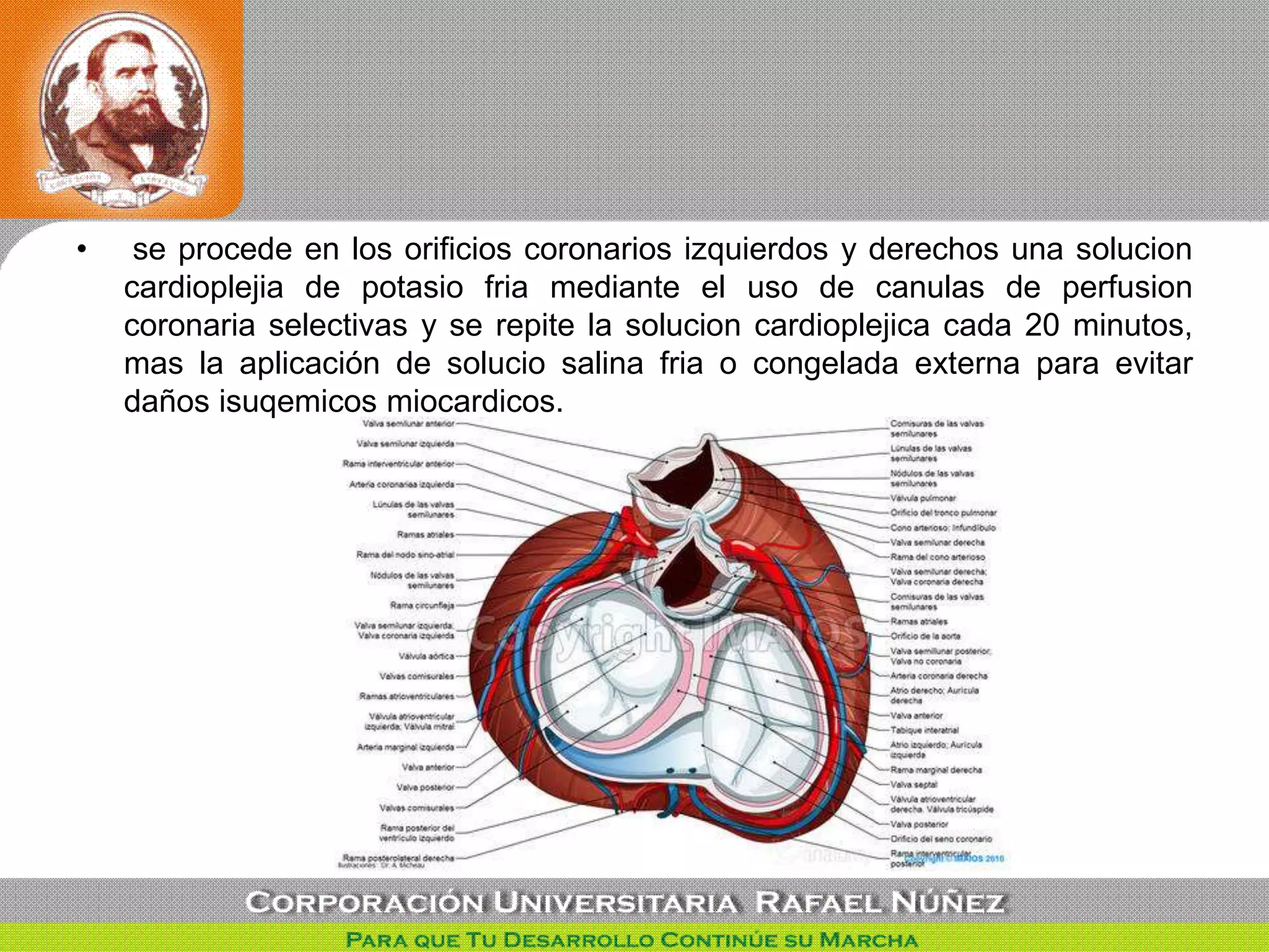 Reemplazo de valvula aortica instrumentacion quirurgica | PPTX