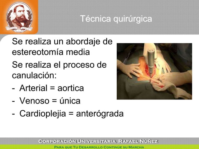 Reemplazo de valvula aortica instrumentacion quirurgica | PPTX