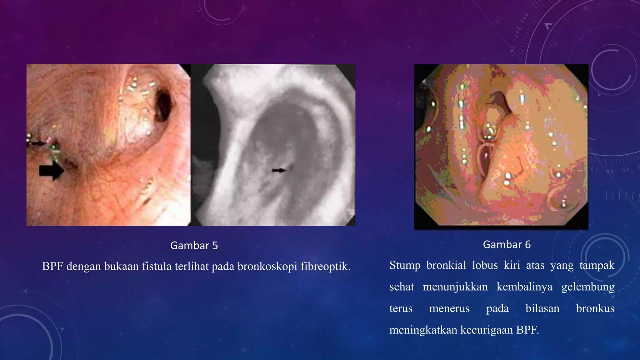 Refarat BPF-Ruby (1).pptx