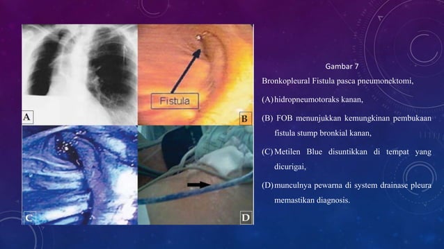 Refarat BPF-Ruby (1).pptx