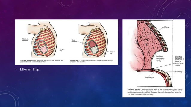 Refarat BPF-Ruby (1).pptx